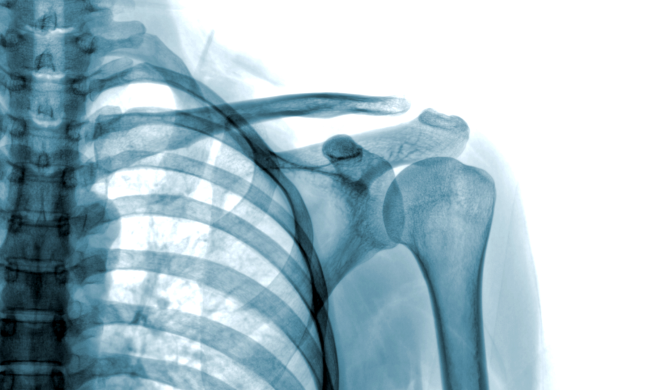 A Nobel Prize-Winning Technique Transformed for Microchip